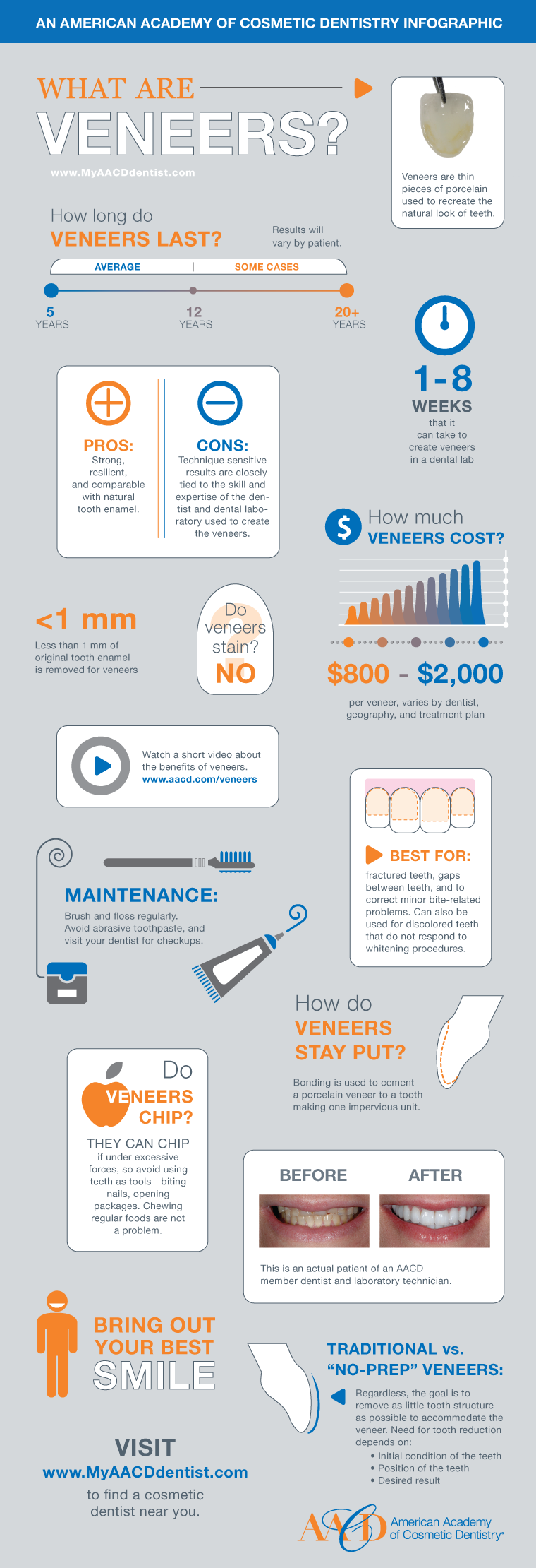 Everything You Need To Know About Veneers Infographic